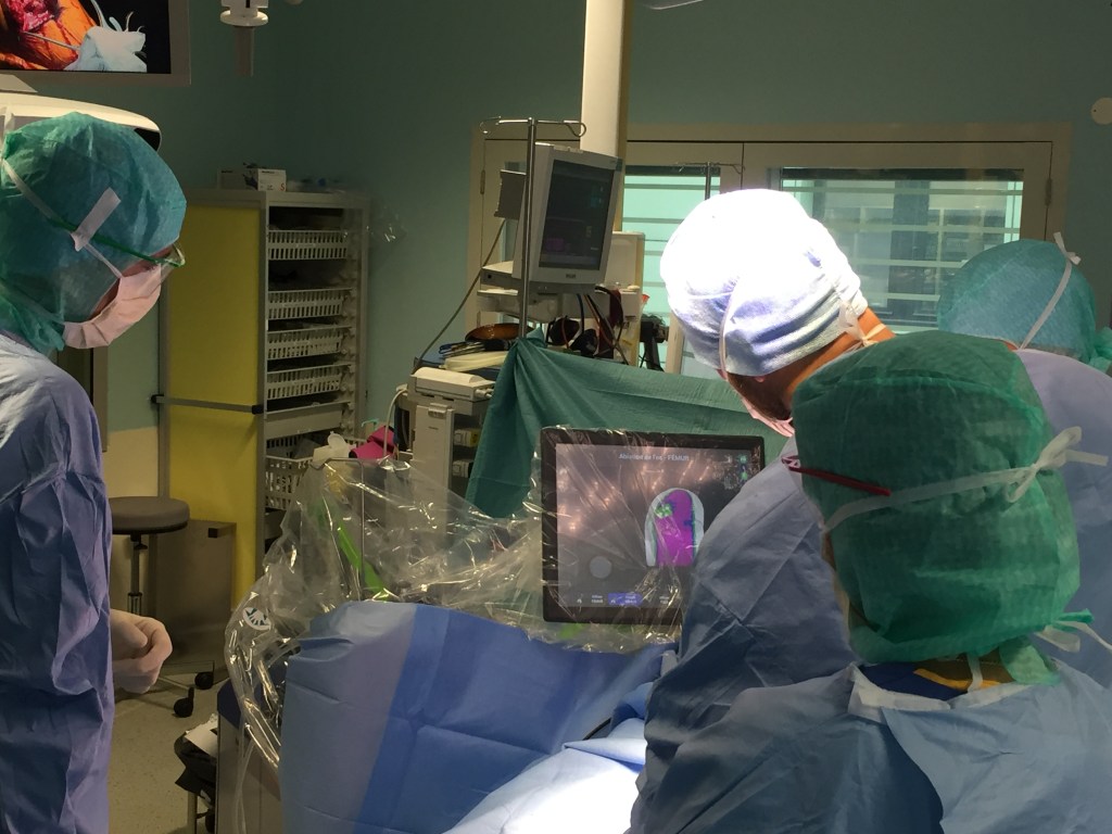 Future of robotic knee navigation total knee replacement with Prof ...