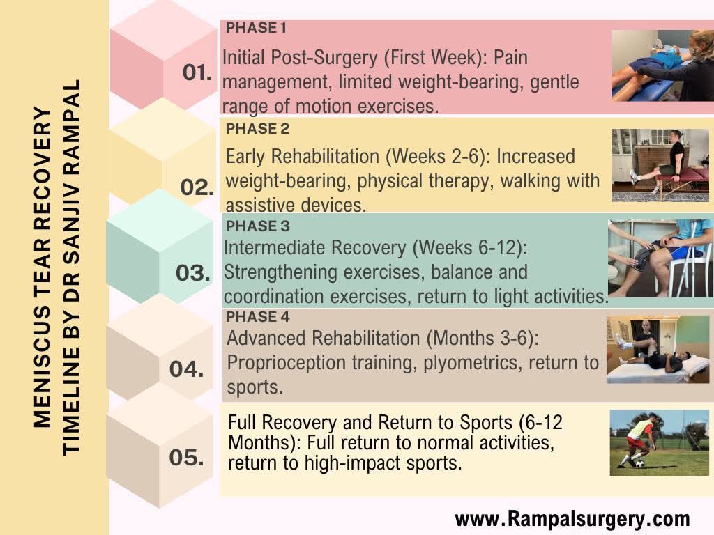 Meniscus Tear Recovery Timeline by Dr Sanjiv rampal – Rampalsurgery. com